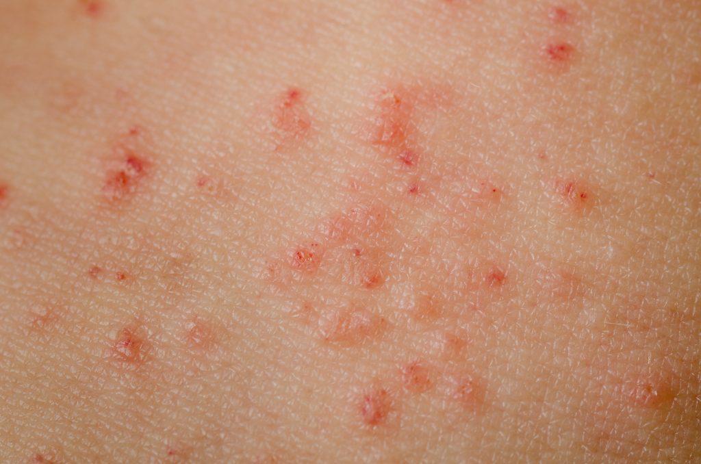 How to Heal Your Gut For Better Skin | Food, Health and You